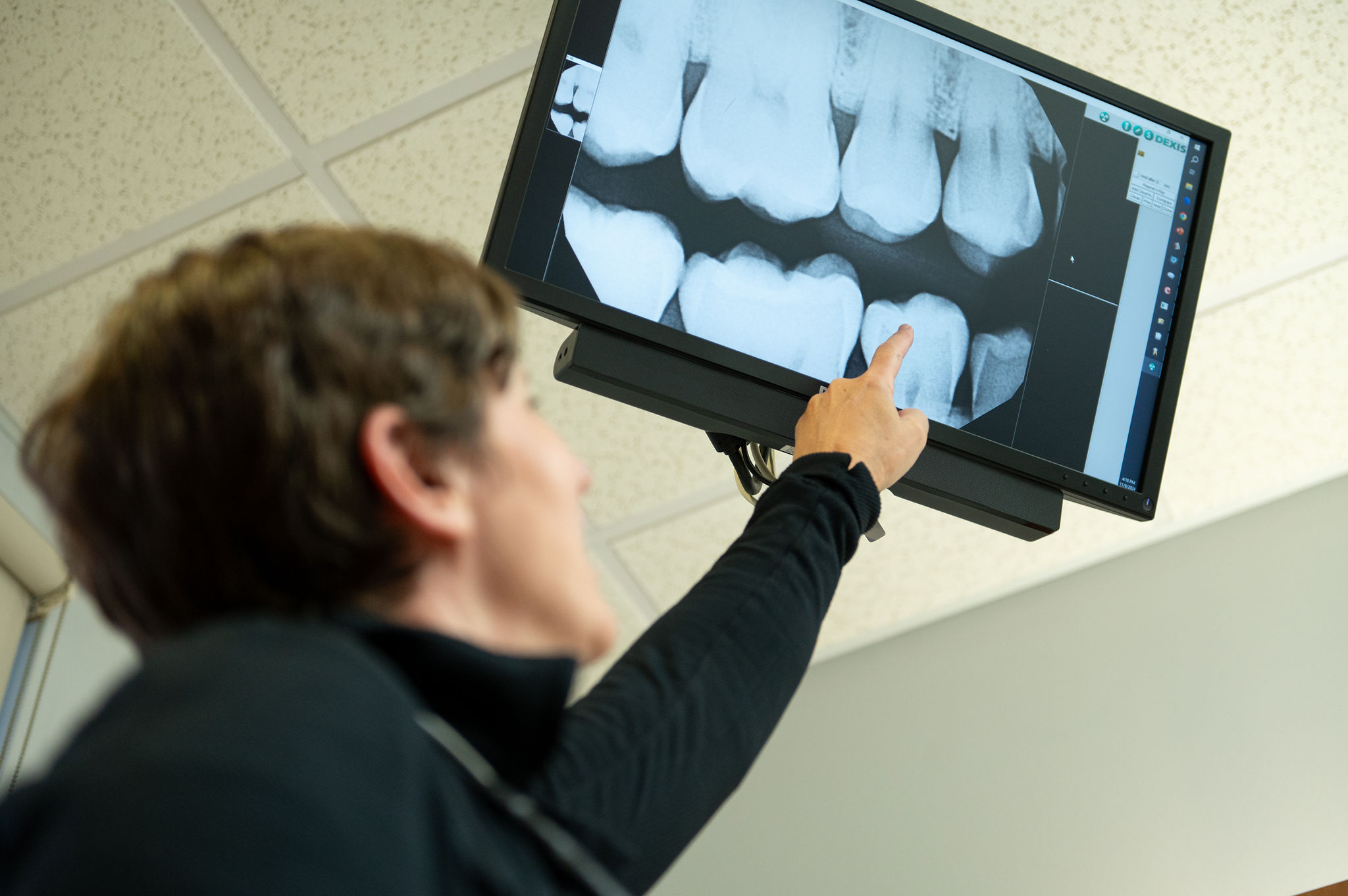 Dentist in St. Peter, MN | Valley View Dental